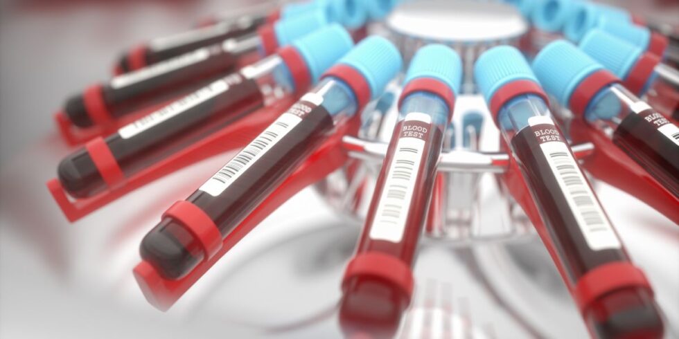 What are Blood Types and What Do They Mean? - SBMF