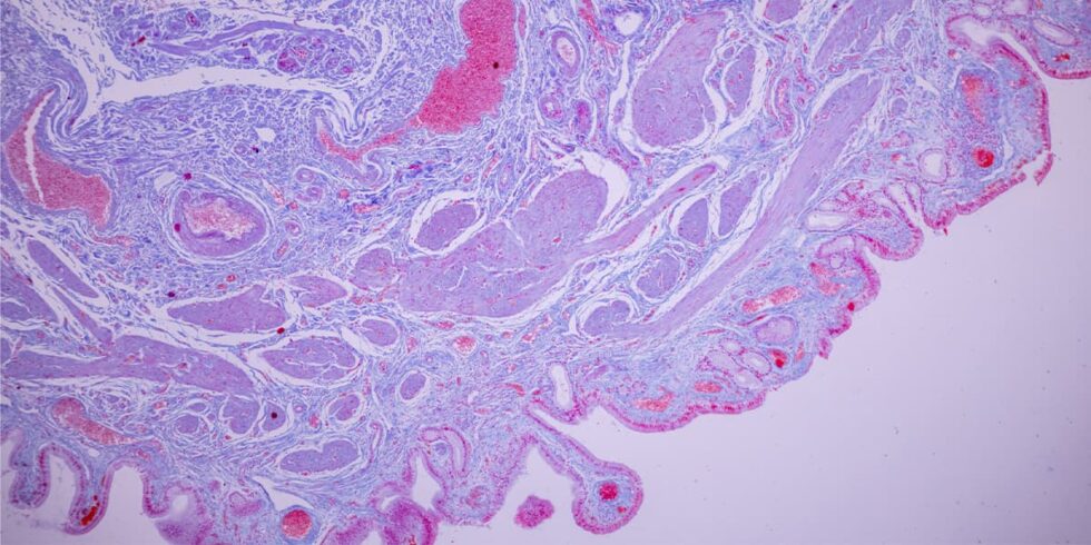 What is Histology? Unlock the Secrets of Tissue - SBMF
